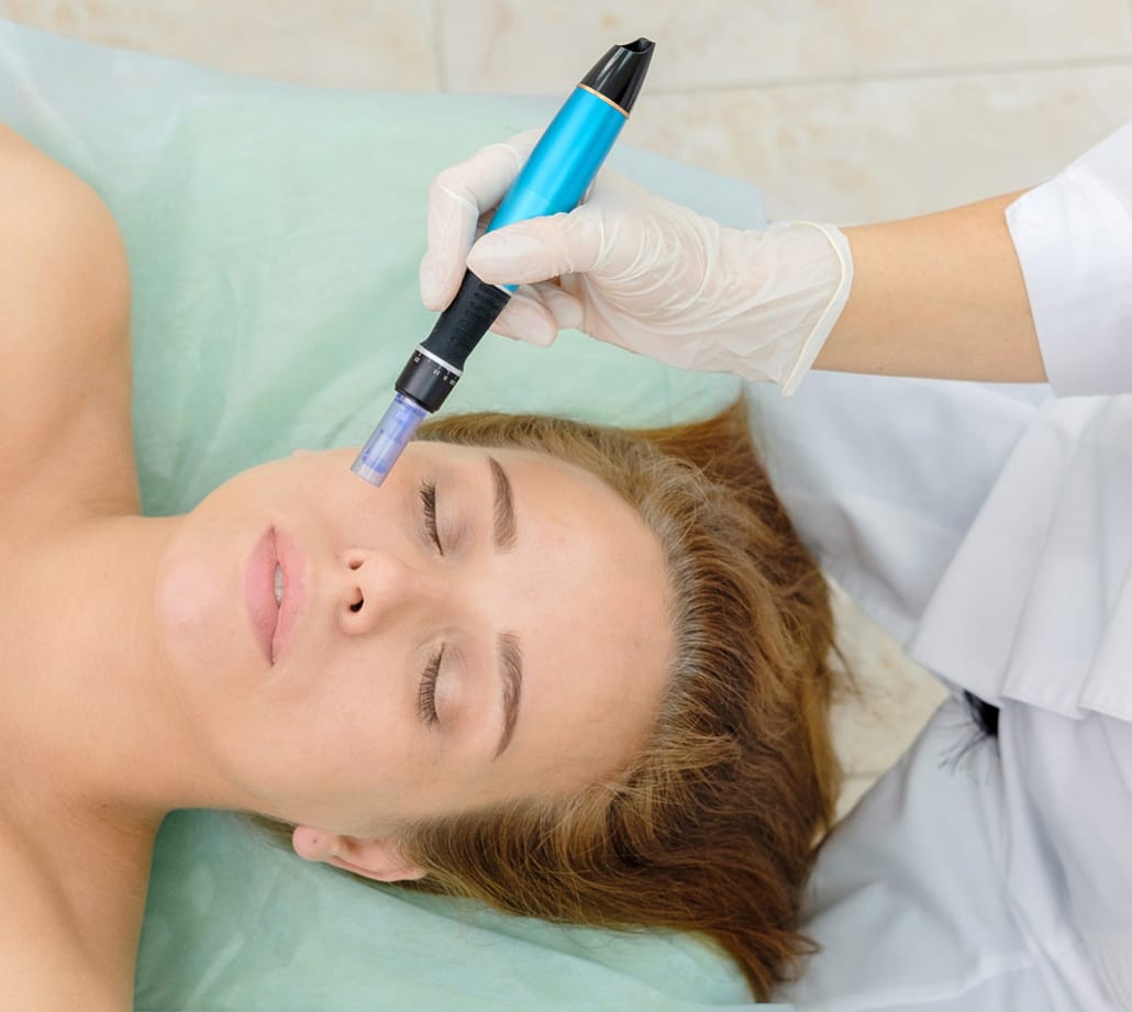 Anti-Aging Treatments – Frequency Specific Micro-Needling & Nano ...